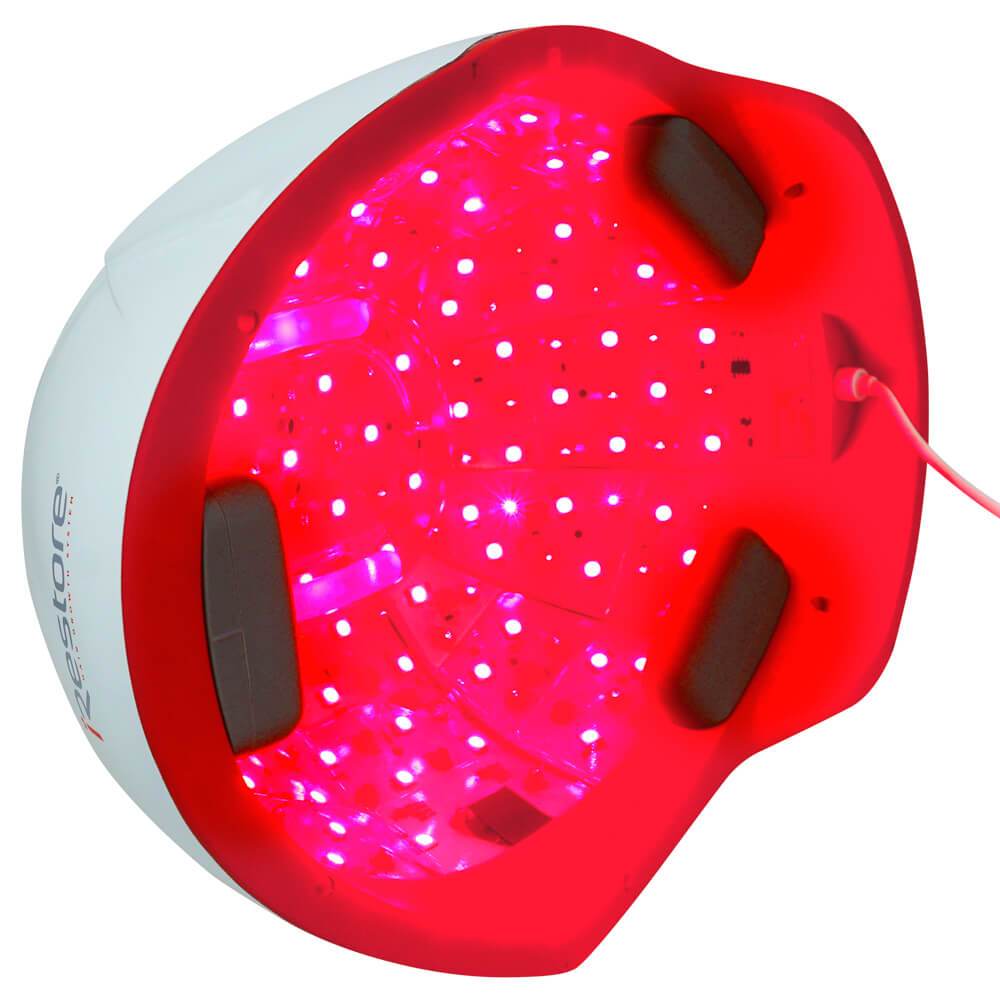 Irestore Laser Hair Growth System Review